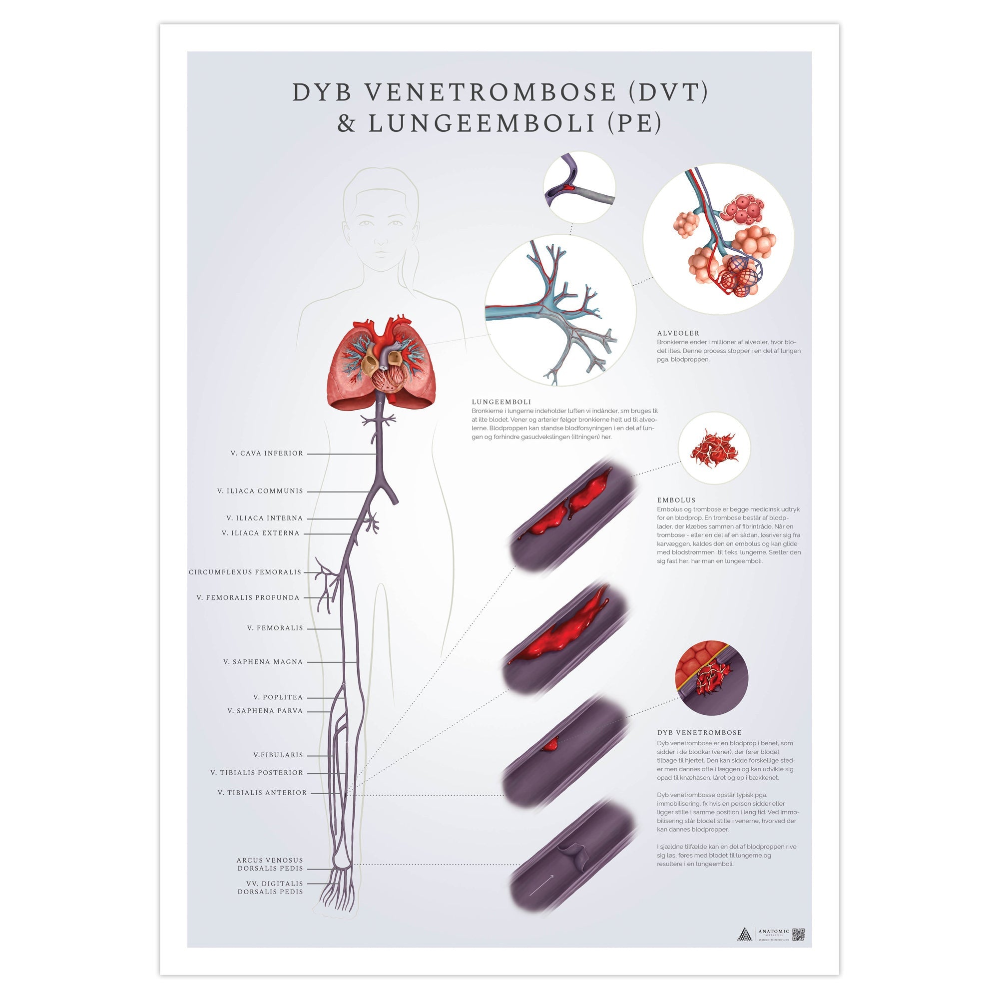 Poster on venous thrombosis and pulmonary embolism © eAnatomy – eAnatomi