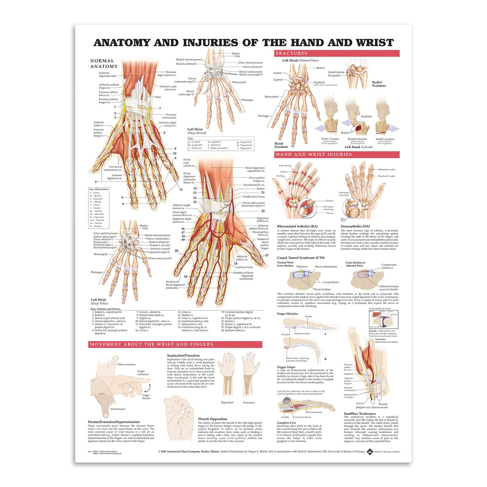 Poster about hand and wrist anatomy & injuries in English – eAnatomi