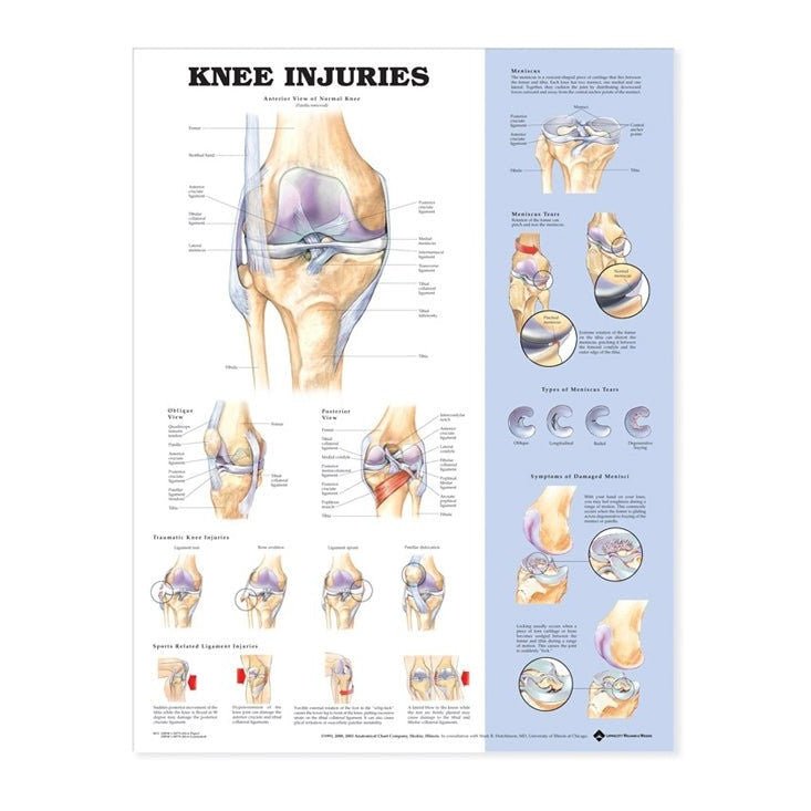 Poster about knee injuries in English - eAnatomi.com